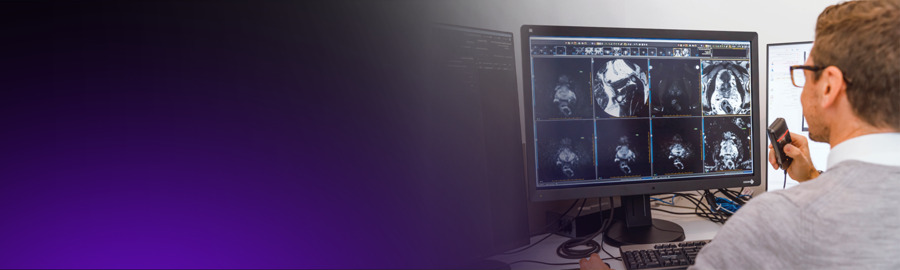 InteleConnect and InteleViewer | Qscan