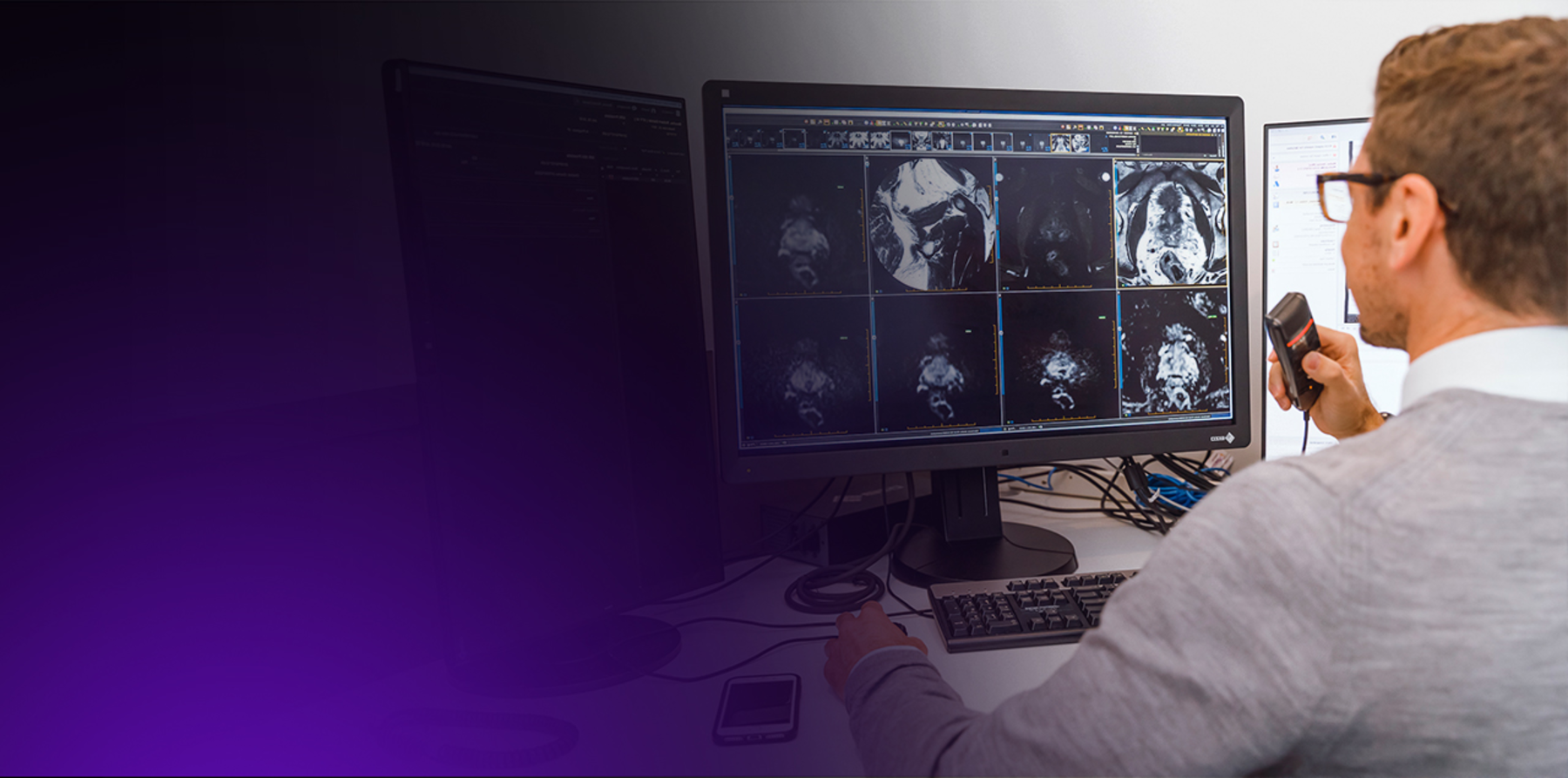 Images and Reports | Qscan